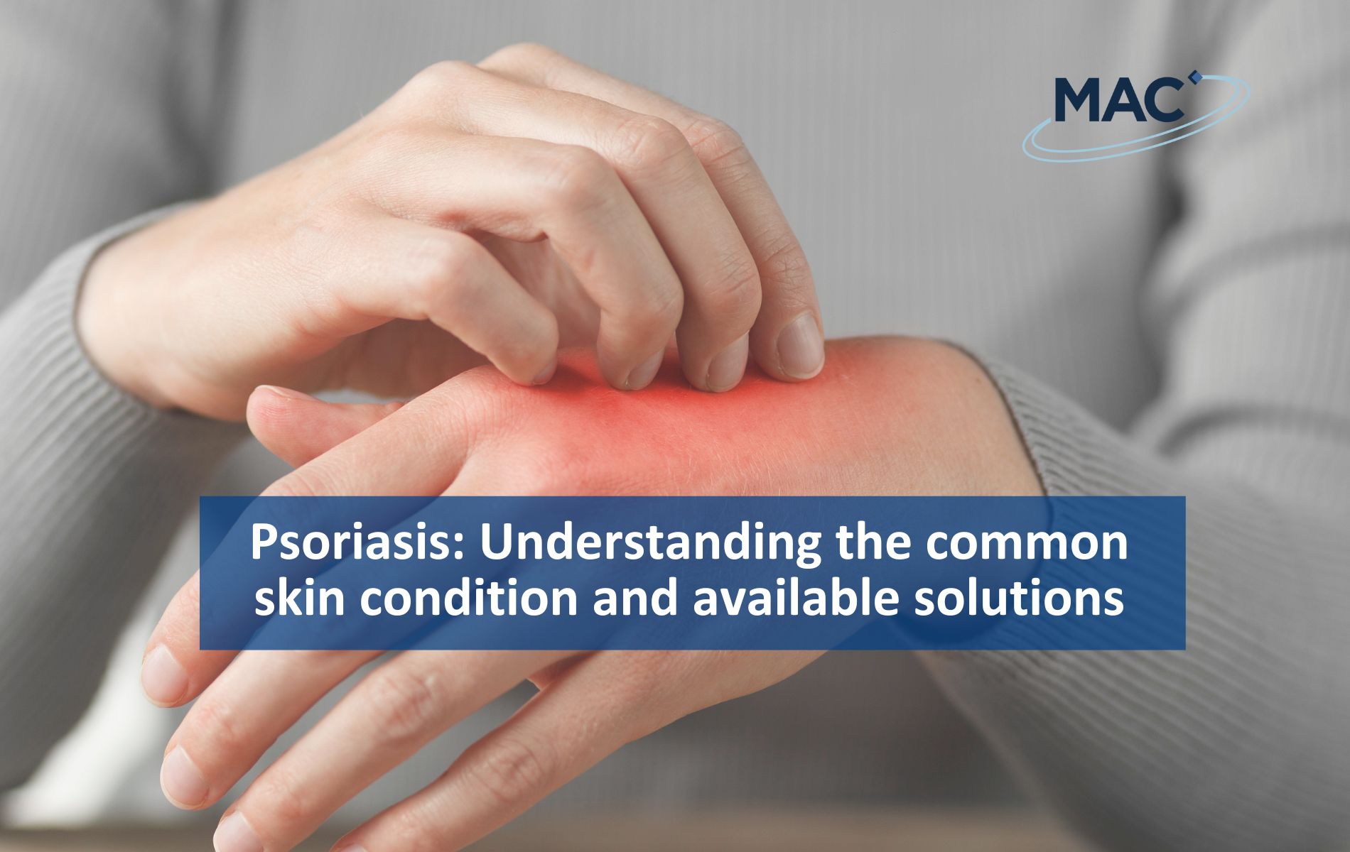 Psoriasis: Understanding the common skin condition and available ...
